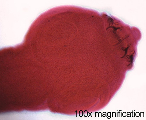 Grantia (Scypha) spicules slide, w.m.